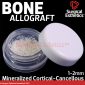 Surgical Esthetics | passionate about regeneration | Bone Graft